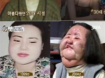 'Thảm họa thẩm mỹ' Han Mi Ok chia sẻ ảnh thời trẻ