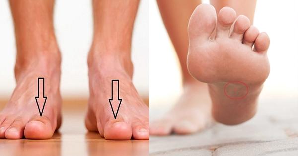 Tướng bàn chân đàn ông may mắn dễ làm quan to
