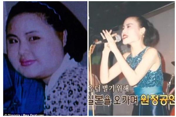 Thảm hoạ thẩm mỹ Han Mi Ok: Tự tiêm dầu ăn và cái chết chấn động